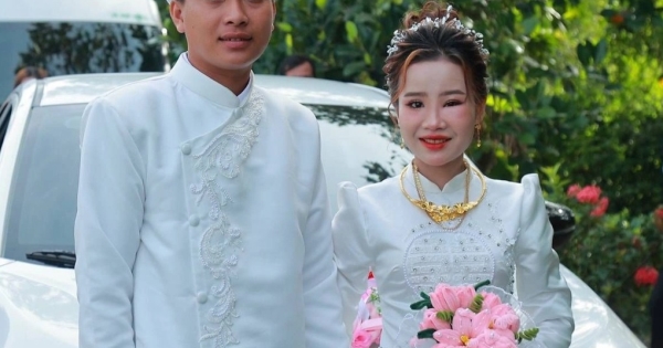 Cô dâu miền Tây "đứng ngồi không yên" vì bị ong đốt sưng mặt trước ngày rước dâu