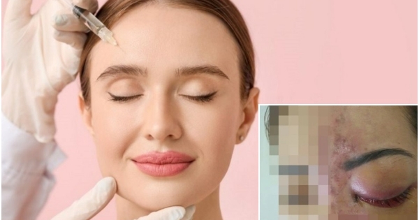 Bi hài chuyện "dao kéo" đổi vận: Tưởng "cầu tài" ai ngờ "rước họa" vì độn trán phong thủy